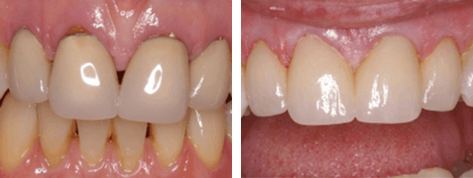 Smile Gallery | Grand Prairie, TX | Definitive Dental